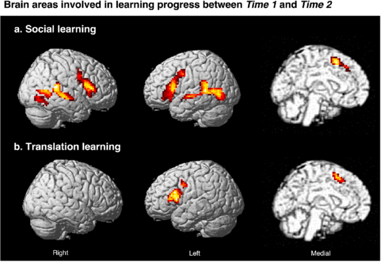 Foreign Language Acquisition and Neurological Change - POLYGLOT DREAMS